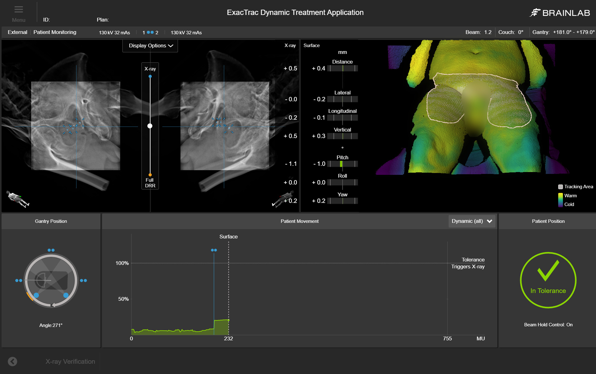 Brainlab ExacTrac Dynamic® - Gold Anchor Marker